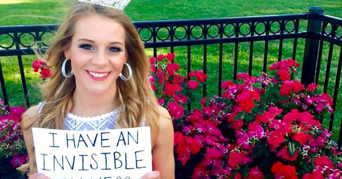 Victoria Graham: la miss con una cicatrice di 63 cm conquista tutti